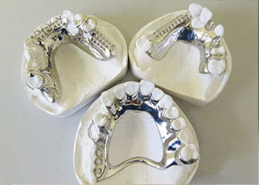 Chrome Frame Dentures | Chrome Dentures | The Natural Denture Clinic